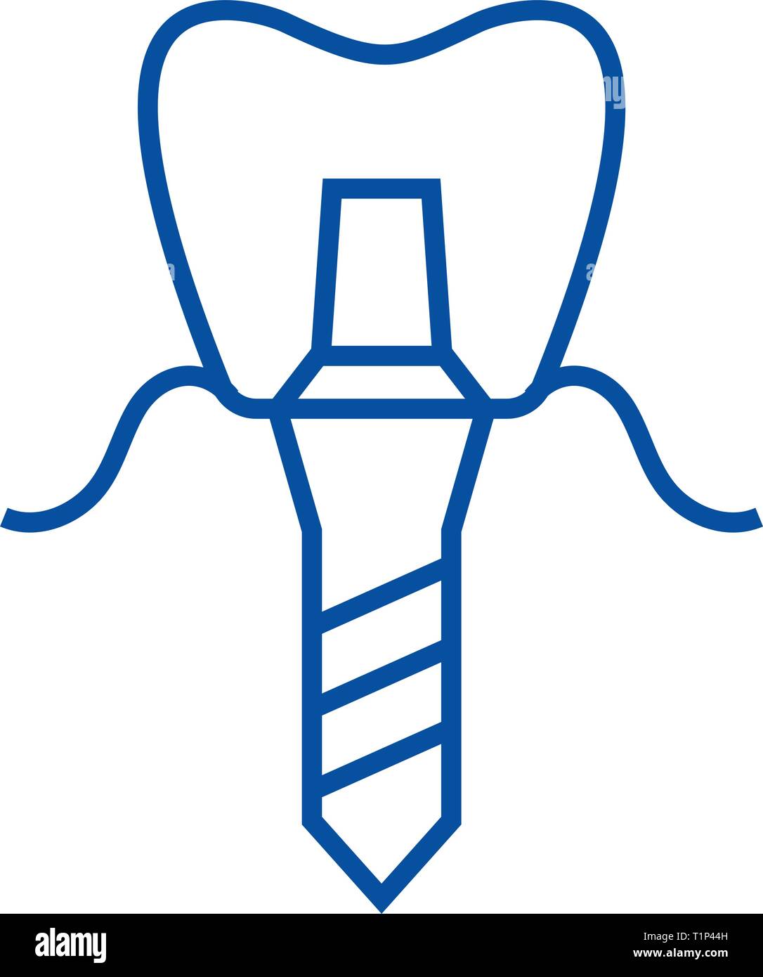 Implantation tooth crown Stock Vector Images - Alamy