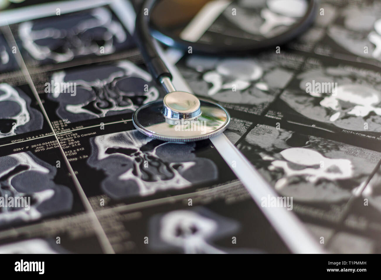 Ct scan sinuses hi-res stock photography and images - Alamy