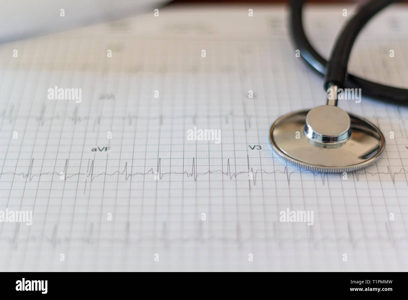 Ecg test hi-res stock photography and images - Alamy