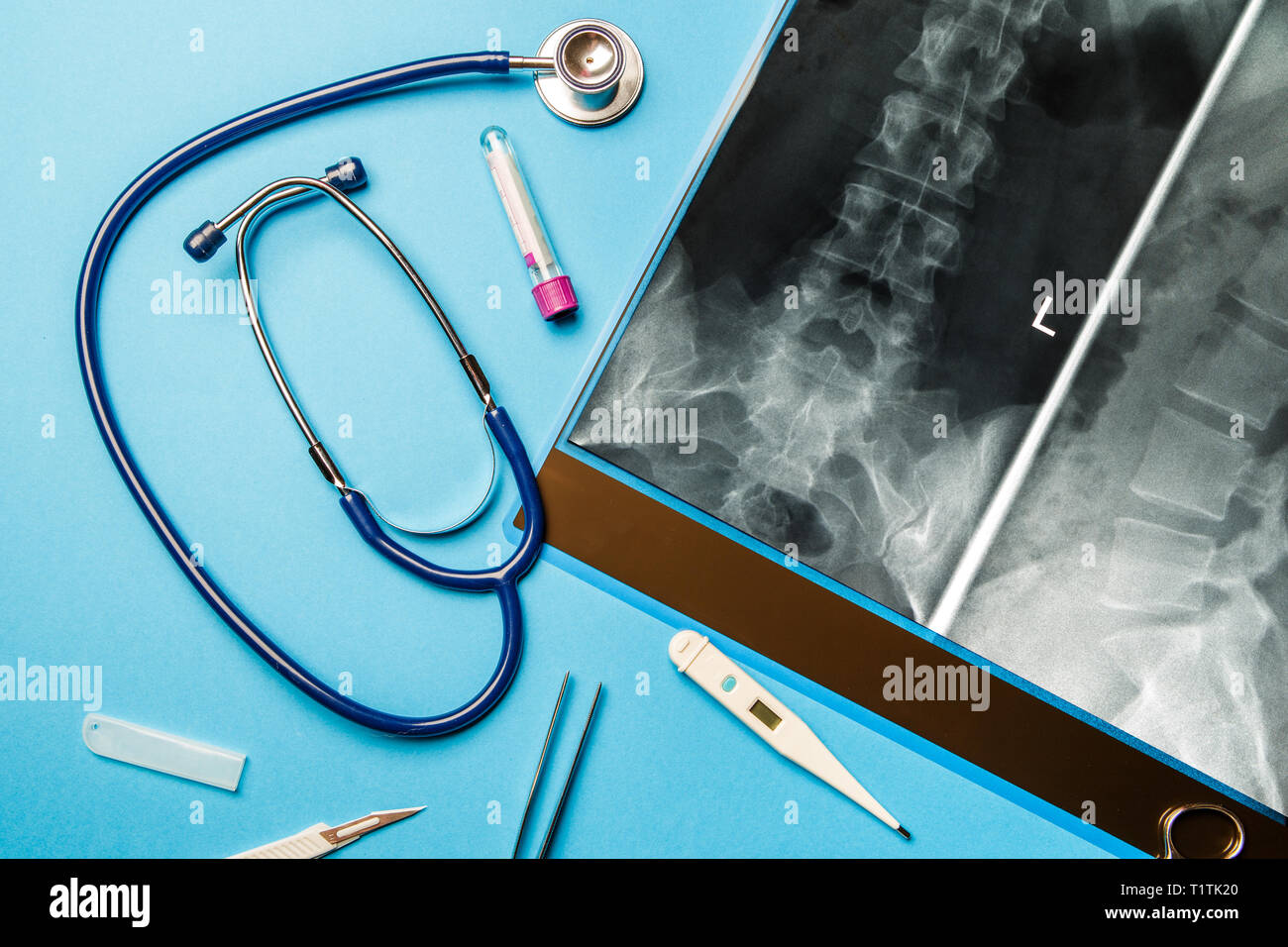 Х-ray and doctor tools on blue surface Stock Photo - Alamy