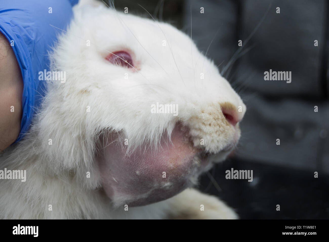 Streptococcal infection hi-res stock photography and images - Alamy