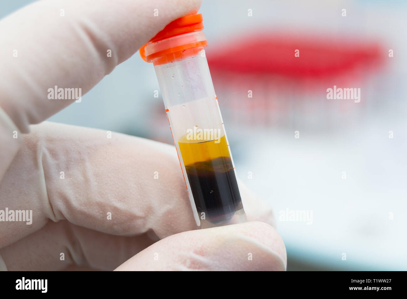 scientist holding in his hand a centrifuged blood sample with hemolysis ...