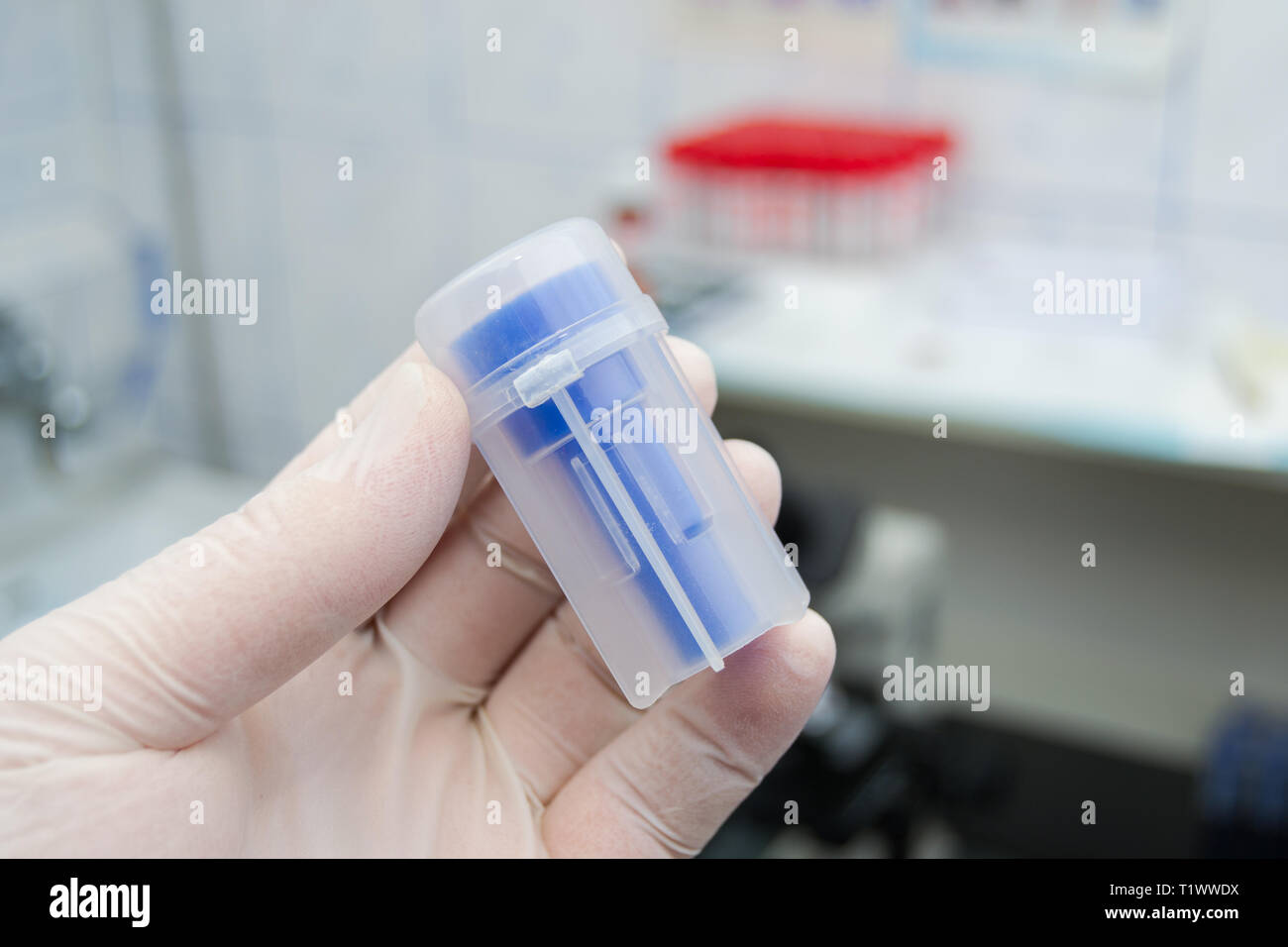 laboratory worker holding in his hand a bottle for feces samples Stock ...