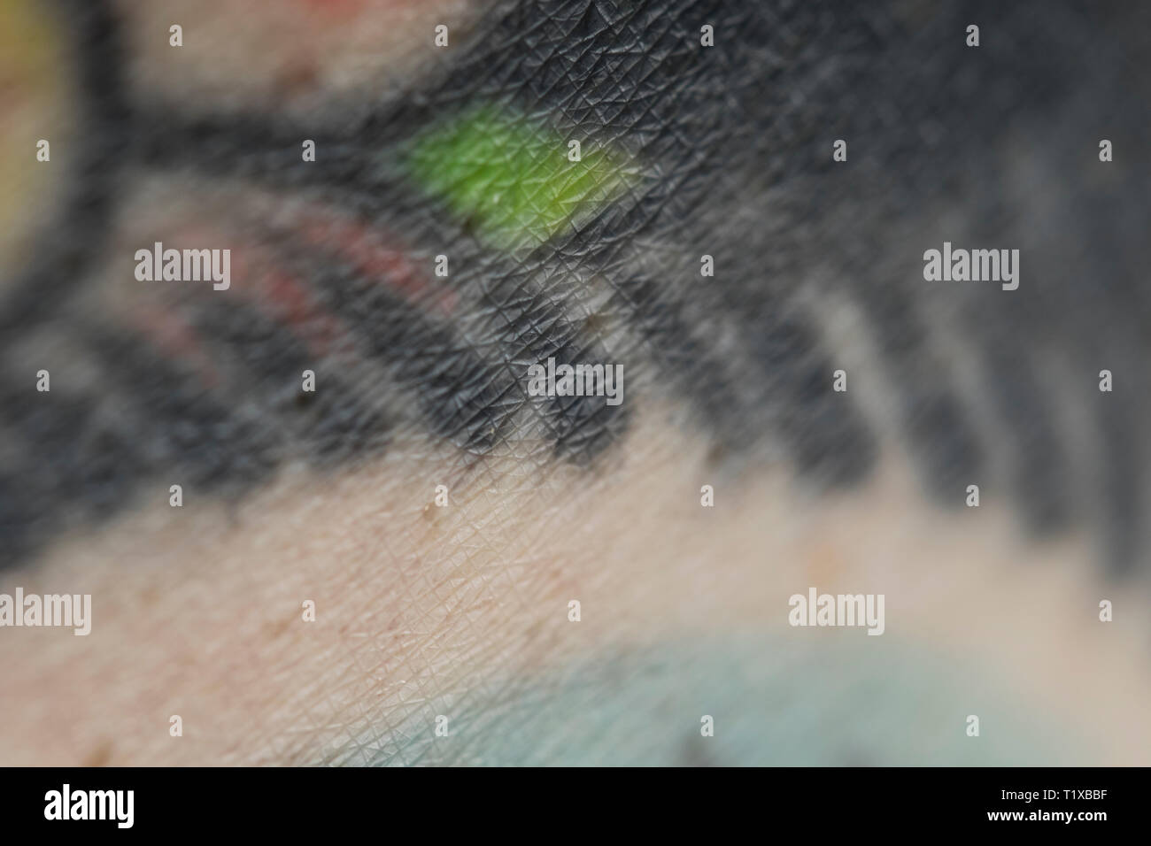 Skin cells microscope hi-res stock photography and images - Alamy