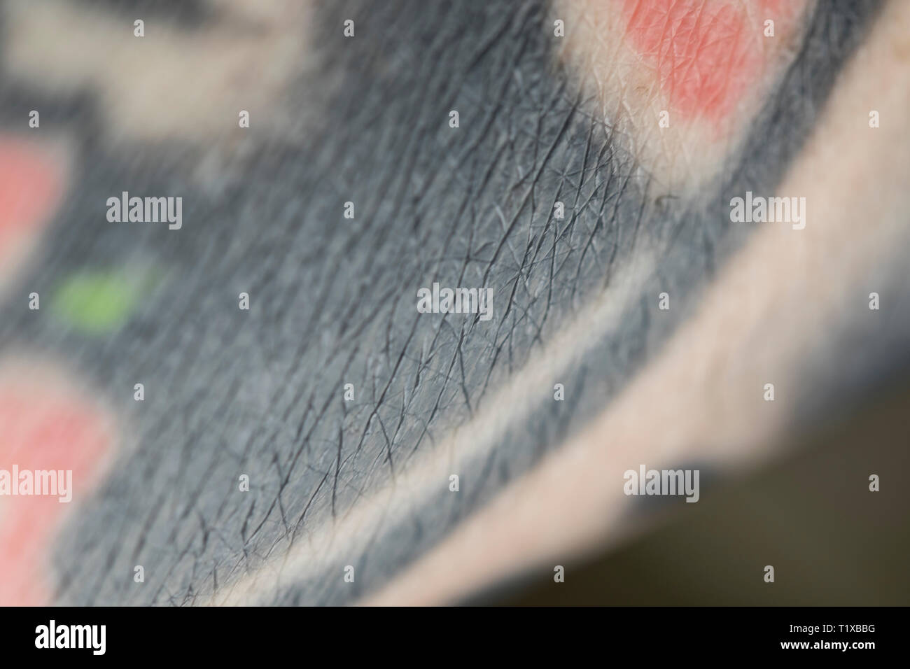 Human skin cells microscope hi-res stock photography and images - Alamy