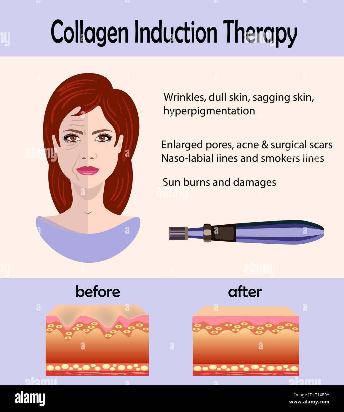 Before and after hi-res stock photography and images - Alamy