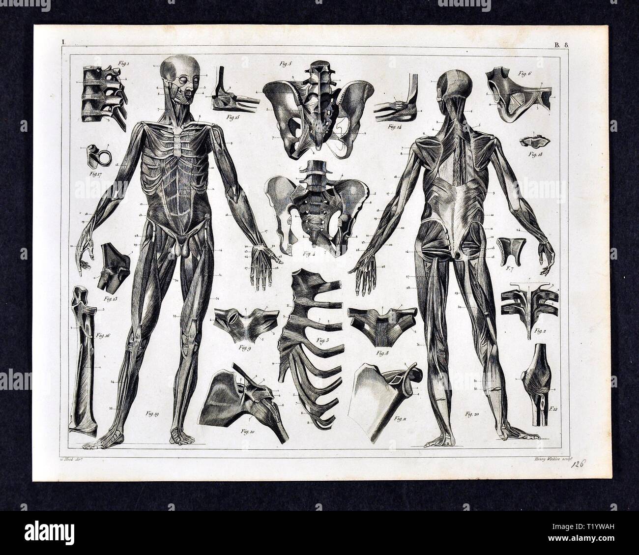 Cadaver dissection illustration hi-res stock photography and images - Alamy