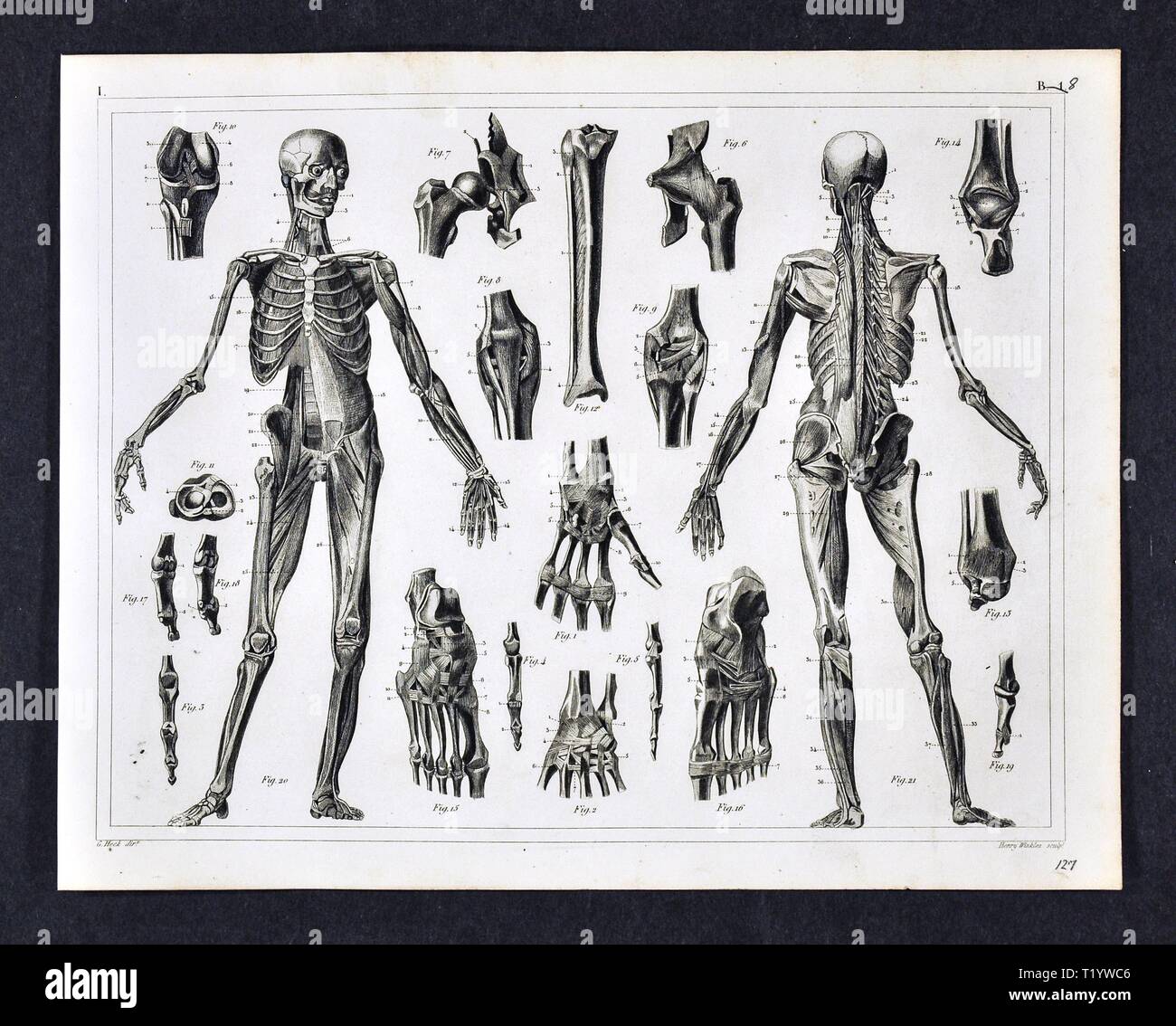 Cadaver Dissection Illustration High Resolution Stock Photography and ...