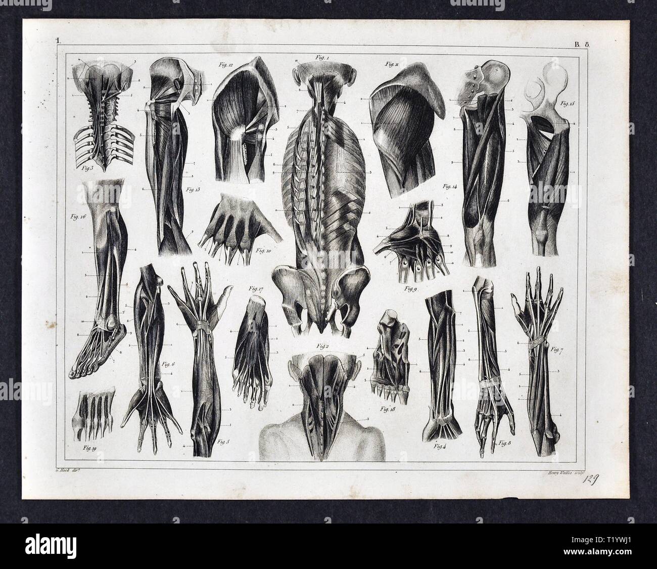 Cadaver dissection illustration hi-res stock photography and images - Alamy