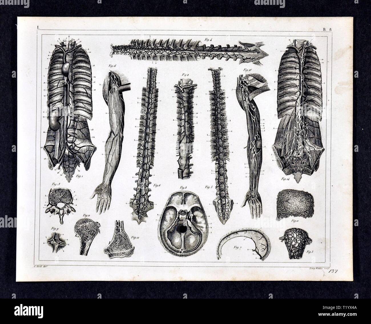 1849 Human Anatomy Print showing Musculoskeletal System including the ...