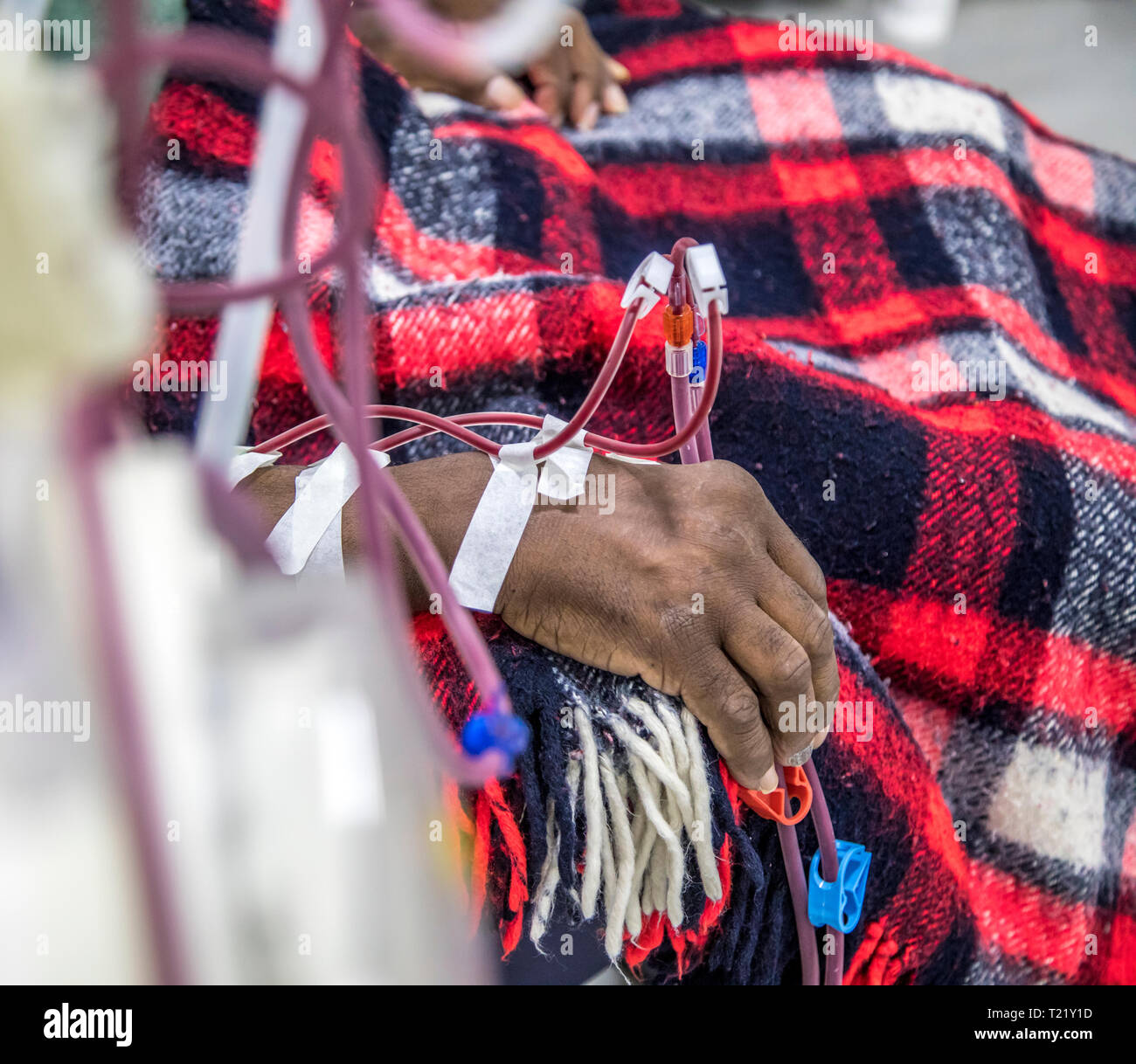Dialysis fluid hi-res stock photography and images - Alamy