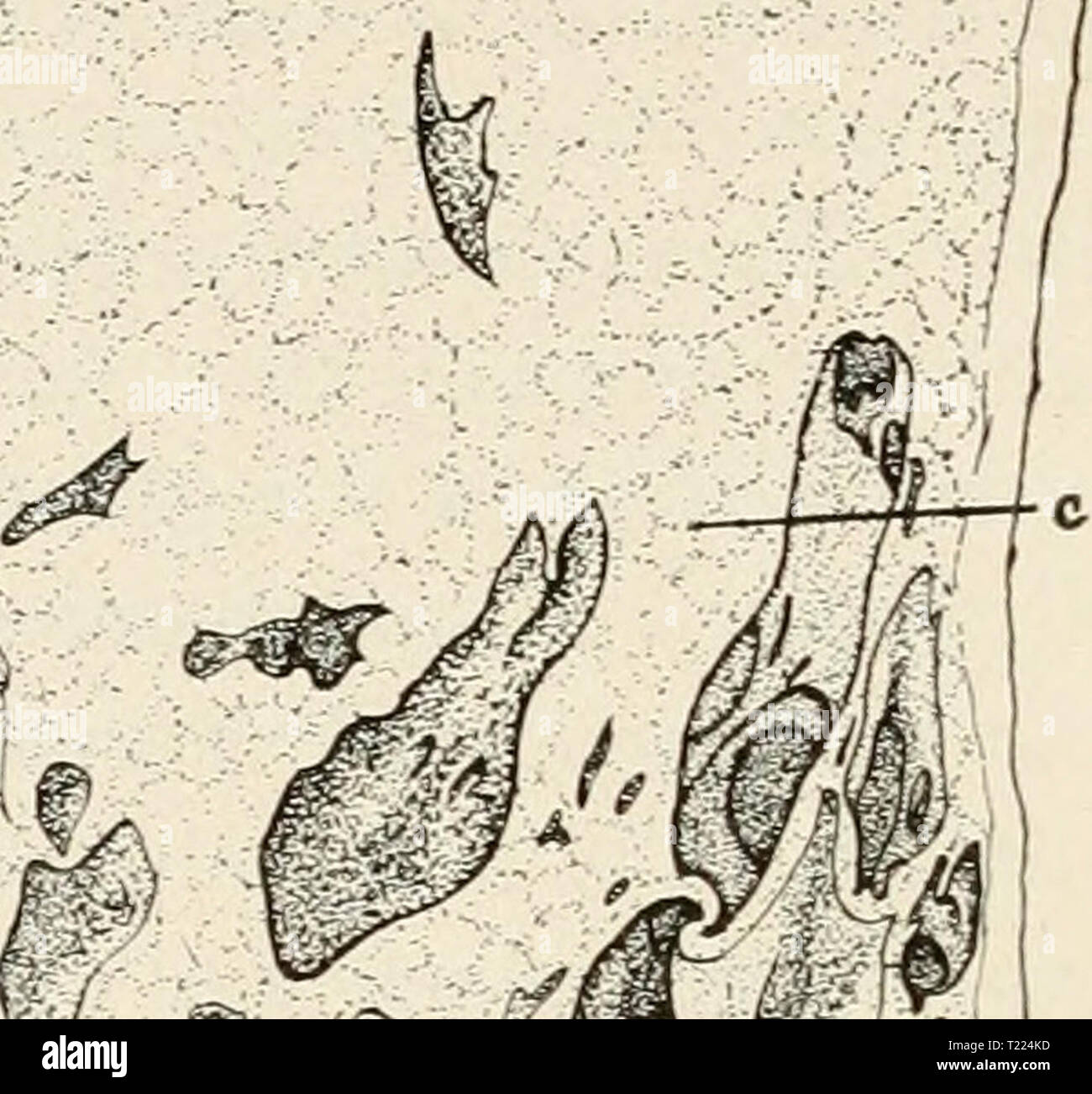 Archive image from page 55 of The pathology and differential diagnosis ...