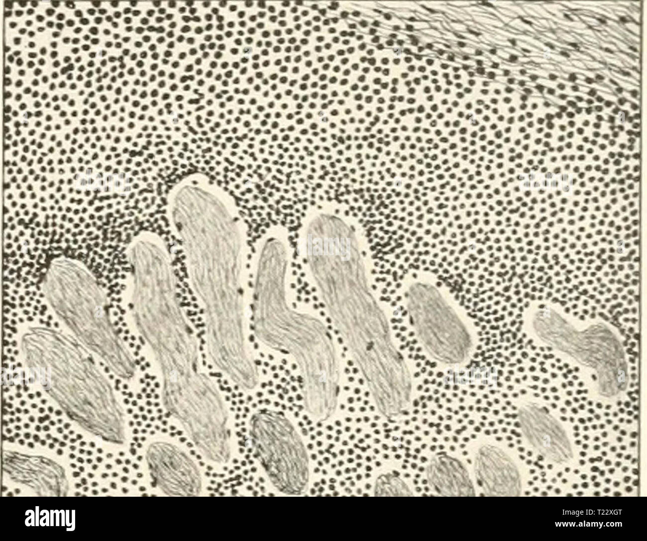 Archive image from page 28 of The pathology and differential diagnosis ...