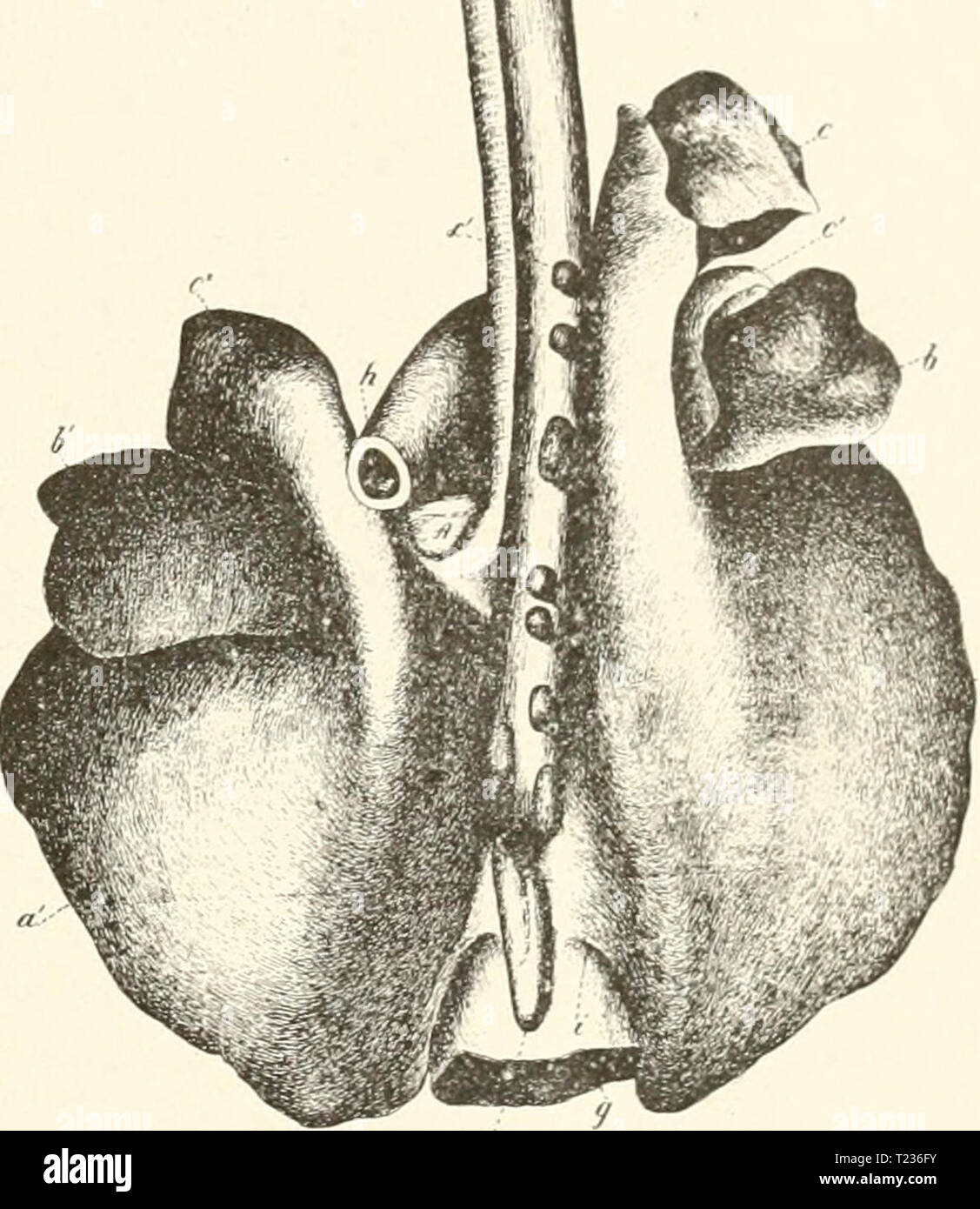 Formation of an abscess hi-res stock photography and images - Alamy