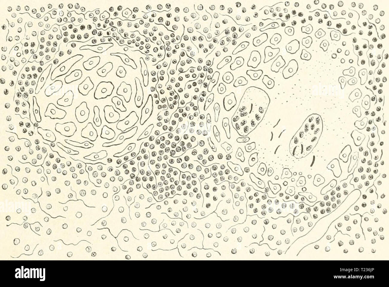 Archive image from page 210 of The pathology and differential diagnosis ...
