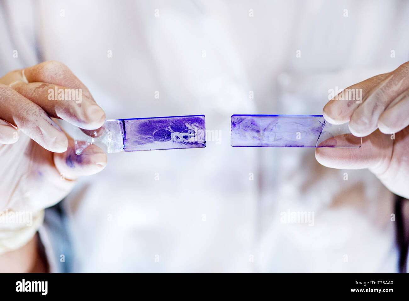 Microbiology laboratory work, comparing results Stock Photo - Alamy