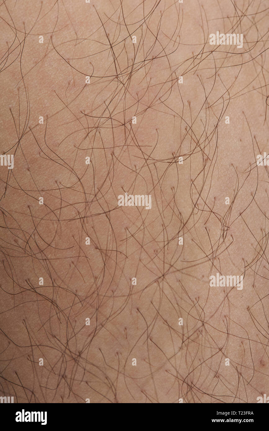 Hairy white skin closeup texture. Detailed human white skin Stock Photo ...