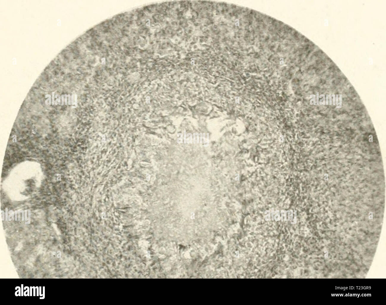Archive image from page 232 of The pathology and differential diagnosis ...