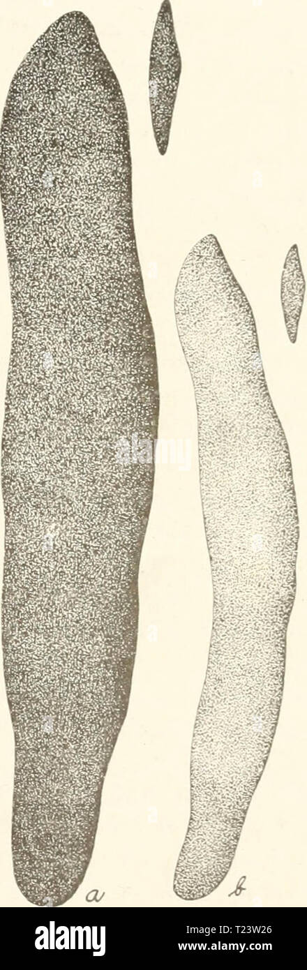 Petechiae hi-res stock photography and images - Alamy