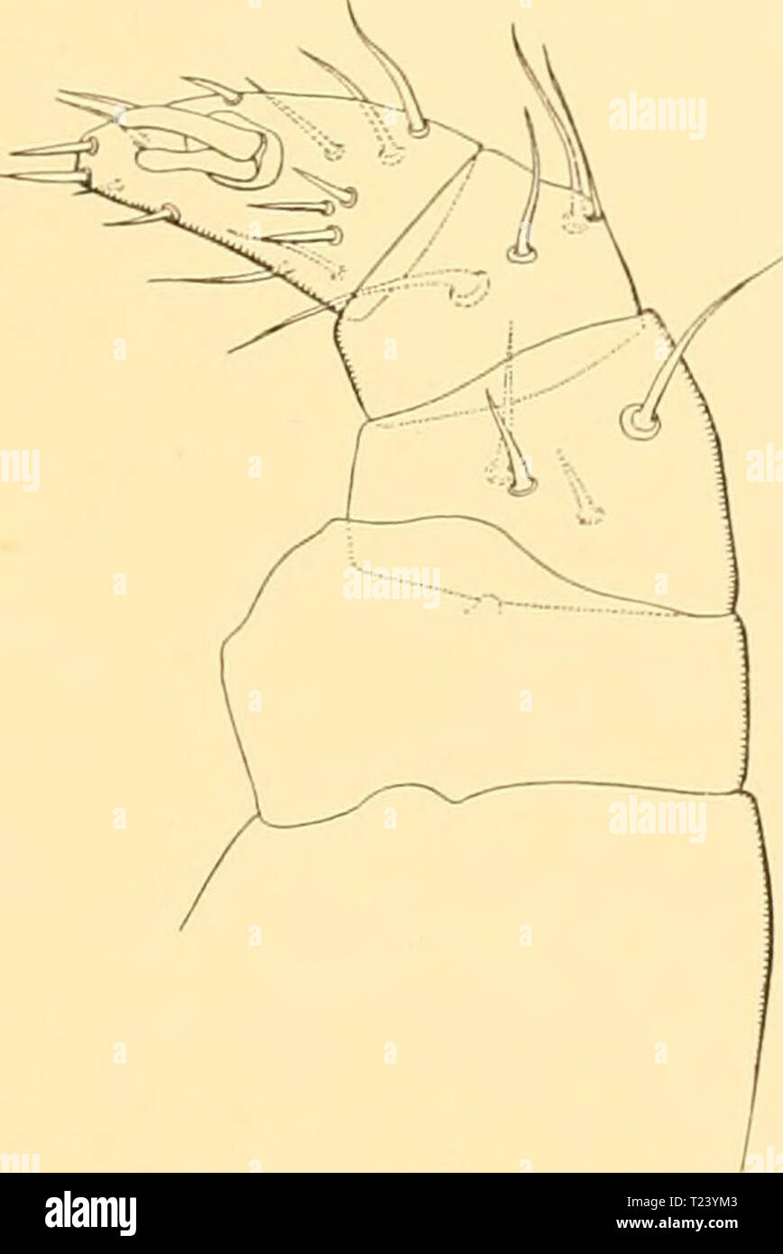 Tibial flap hi-res stock photography and images - Alamy