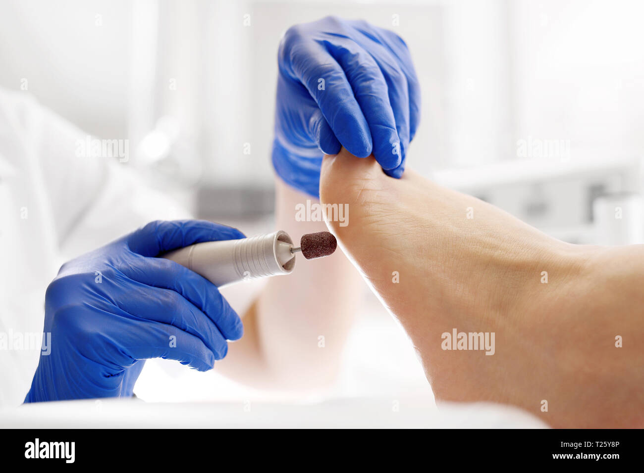 Calluses hi-res stock photography and images - Alamy