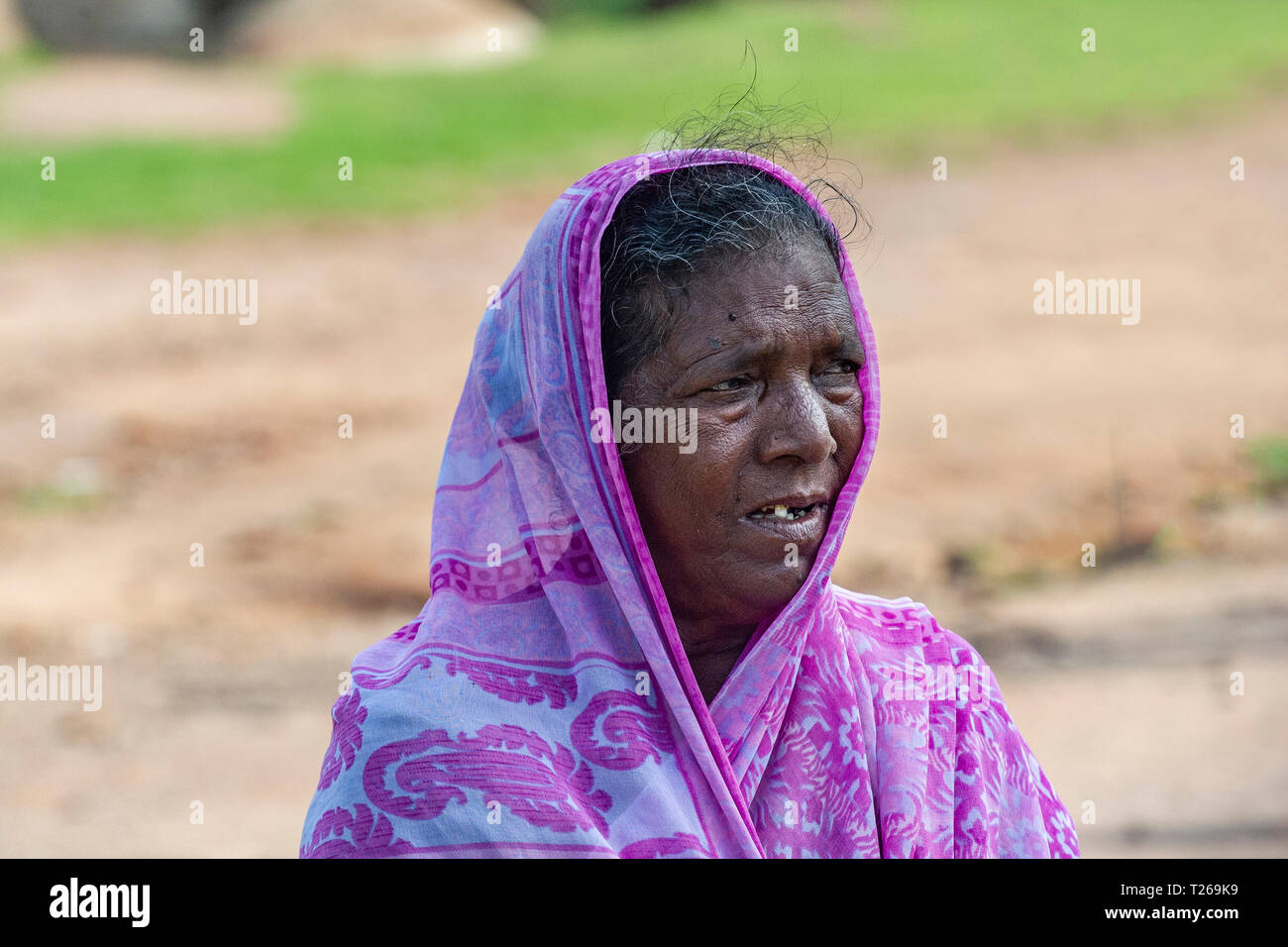 Missing teeth woman hi-res stock photography and images - Alamy