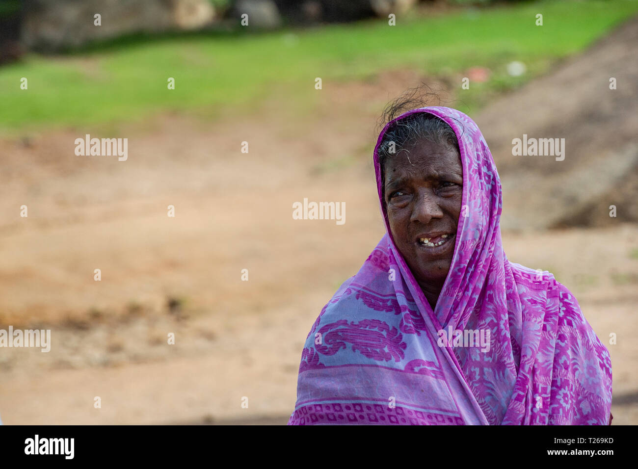 Missing teeth woman hi-res stock photography and images - Alamy