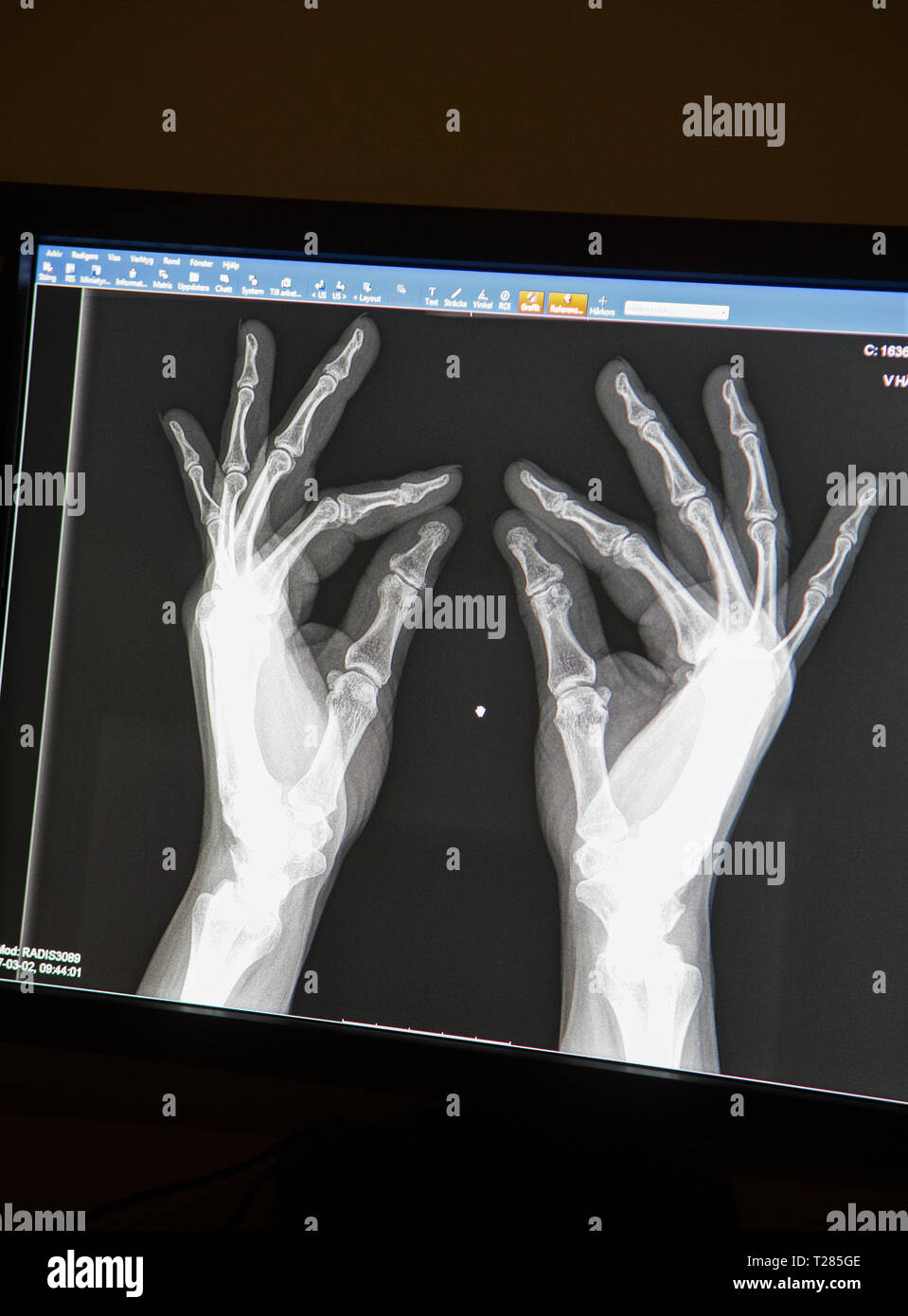 Xray in use hi-res stock photography and images - Alamy