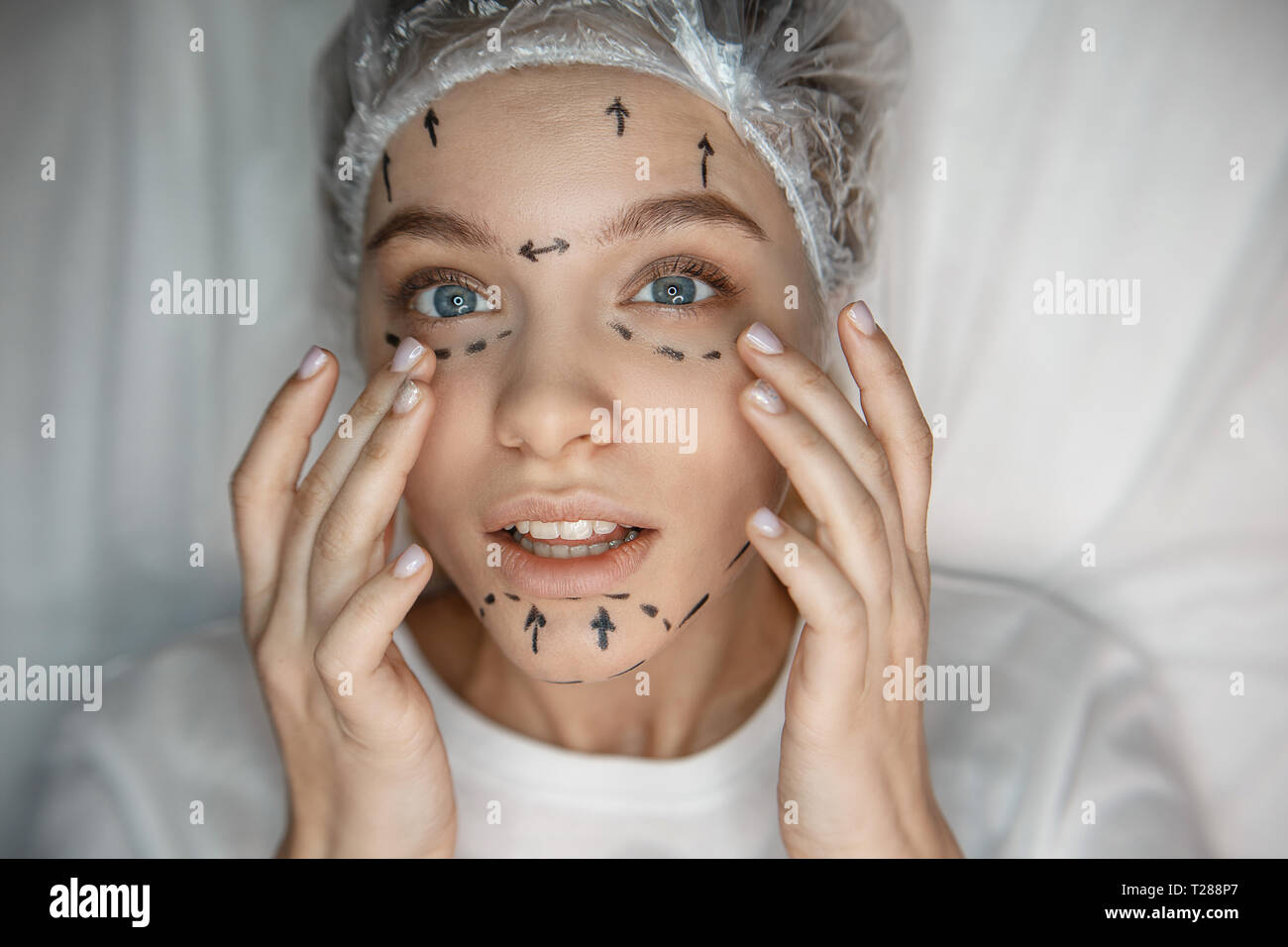 Young woman touching her face and look on camera. She has marks on skin ...
