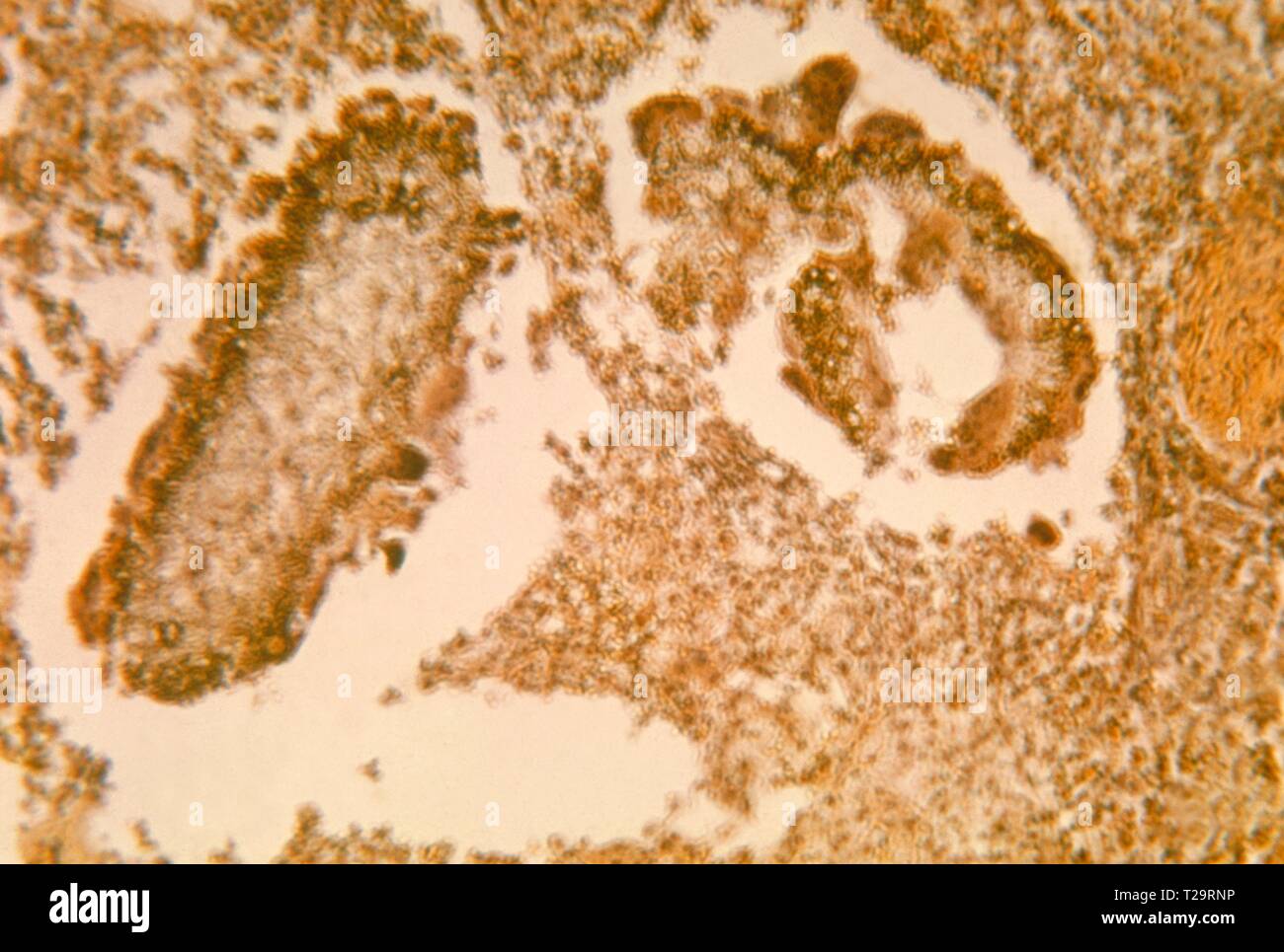 Curvularia geniculata hi-res stock photography and images - Alamy