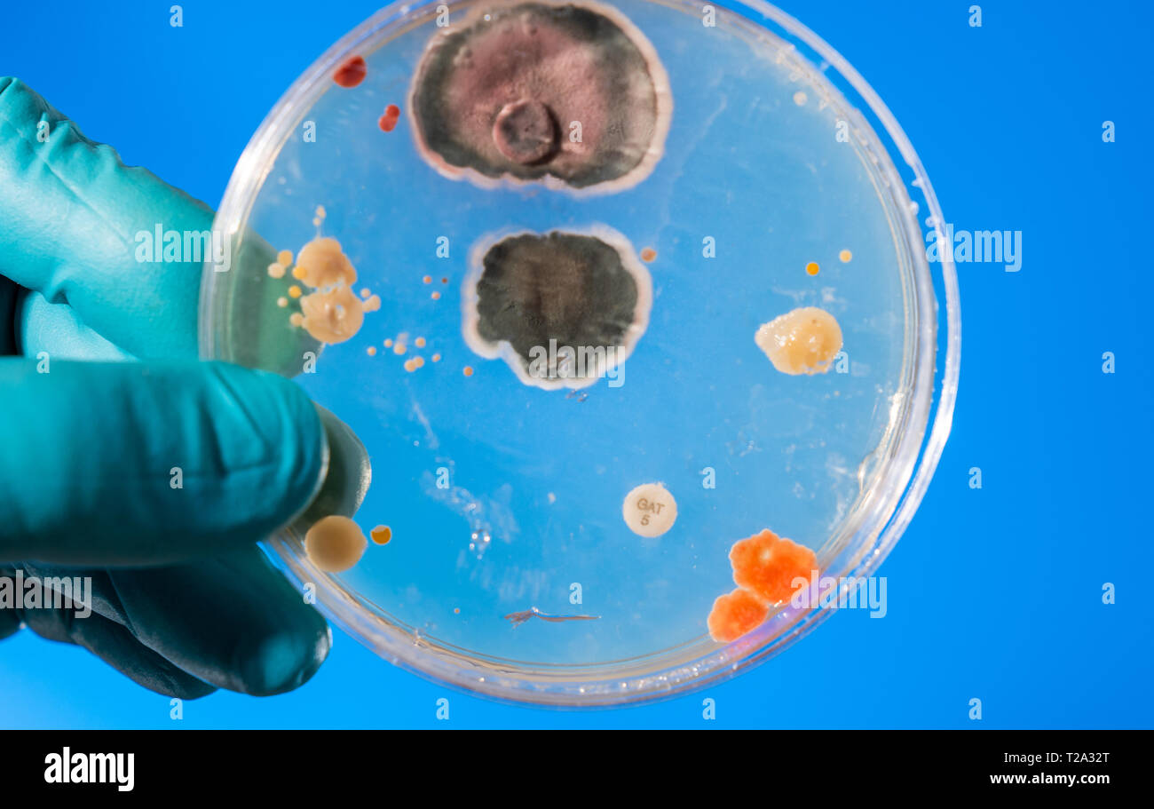petri dish with microbe colony in doctor hand Stock Photo - Alamy
