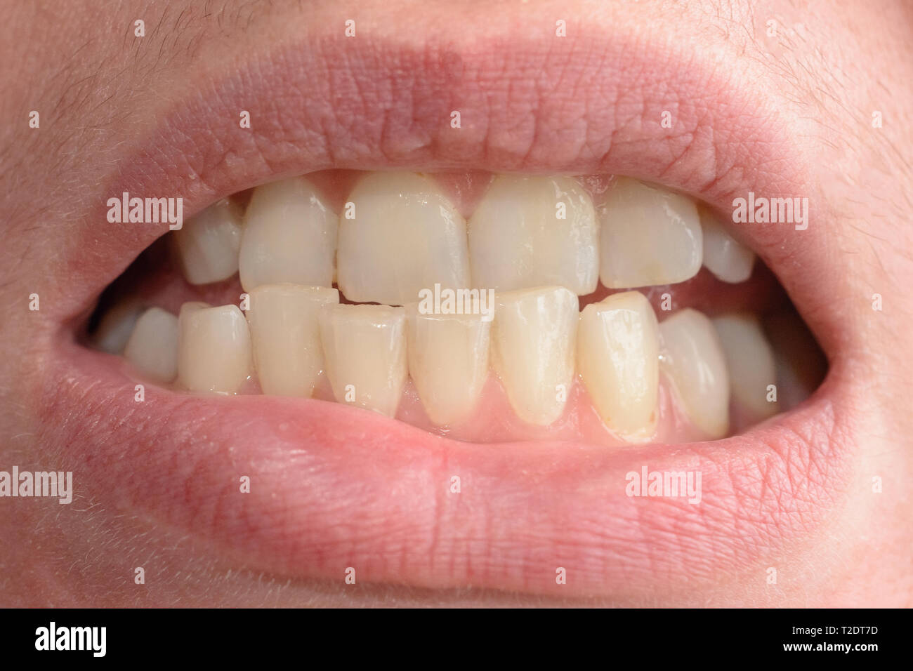 Ugly woman old teeth hi-res stock photography and images - Alamy