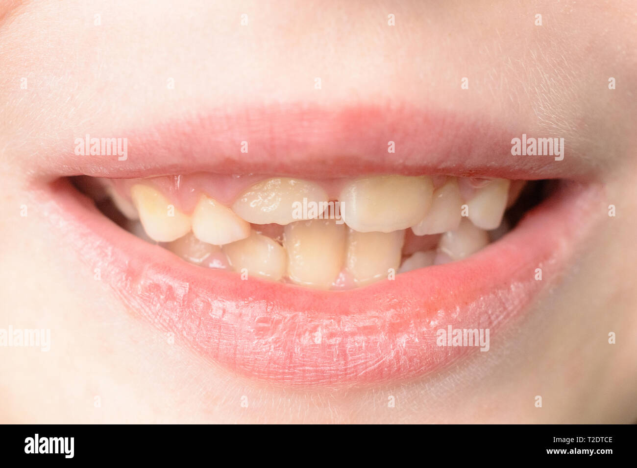 Curved braces hi-res stock photography and images - Alamy