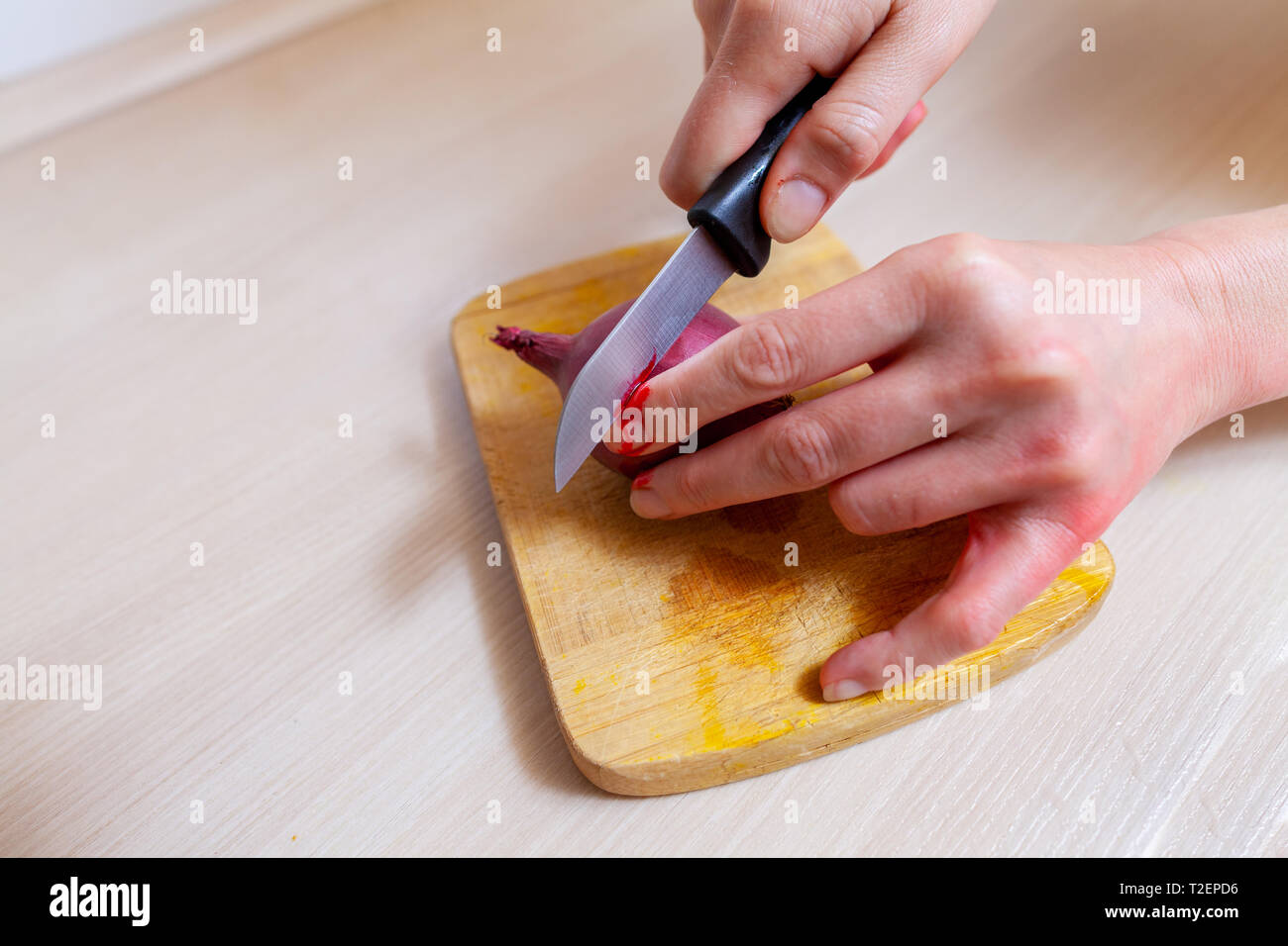 Finger cut kitchen bandage hi-res stock photography and images - Alamy