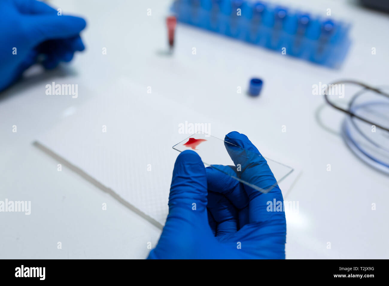 scientist prepare blood sample for research on microscope. Placing ...