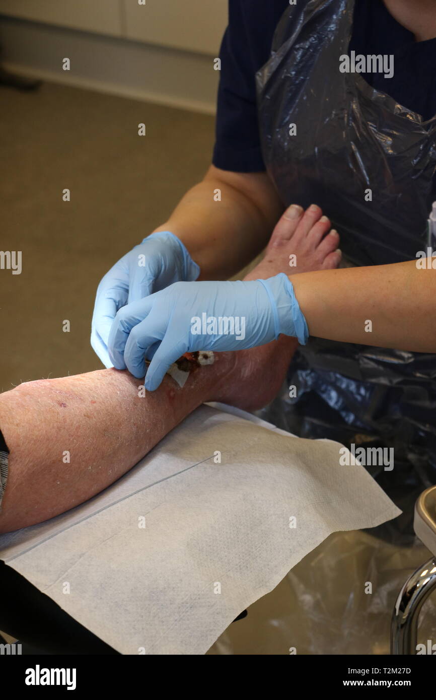 Wound care nurse hi-res stock photography and images - Alamy
