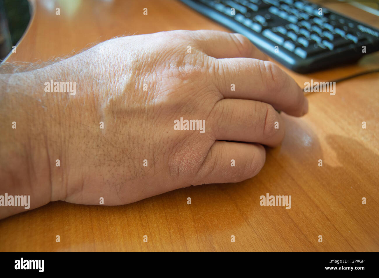 Disabled person using a computer mouse hi-res stock photography and ...