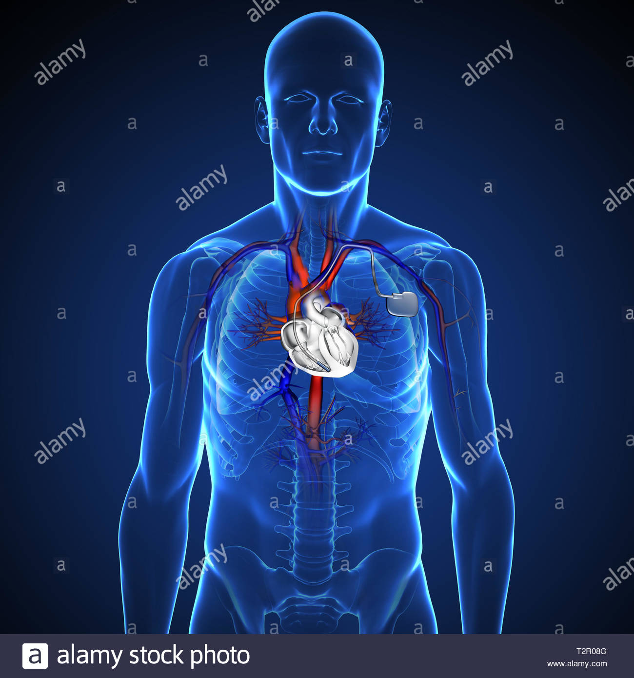 Myocardia Stock Photos & Myocardia Stock Images - Alamy