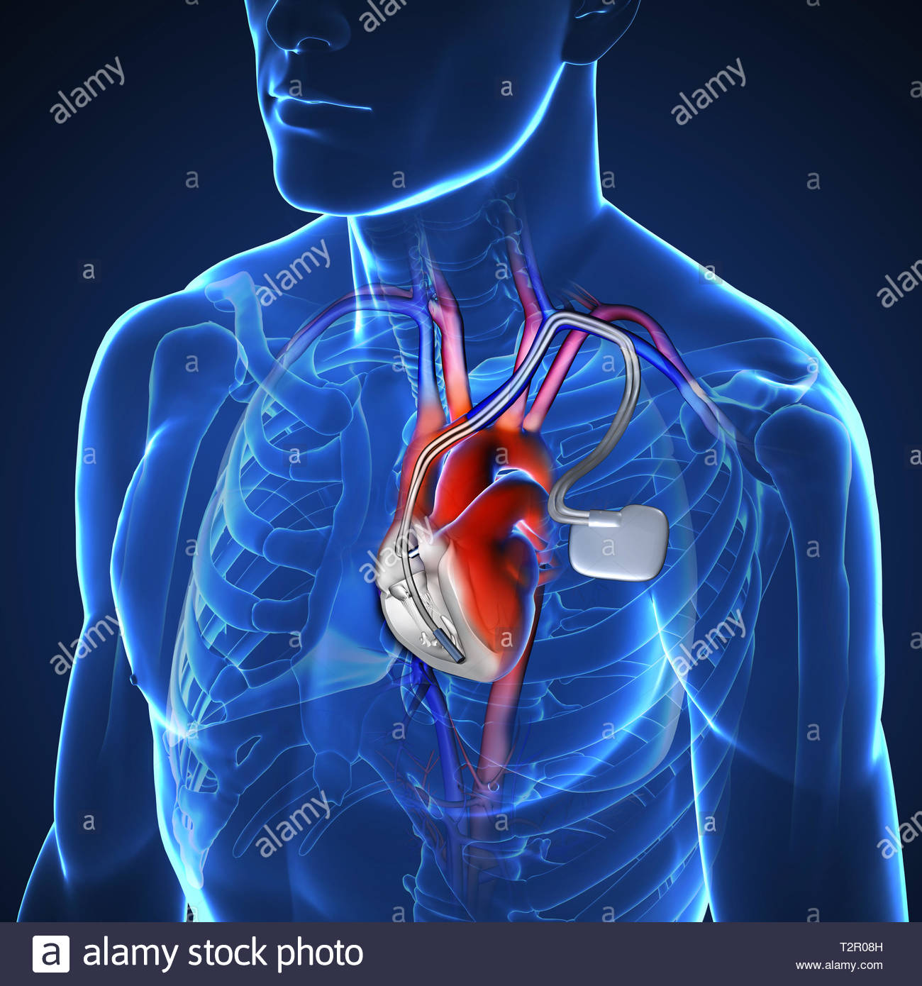 Myocardia Stock Photos & Myocardia Stock Images - Alamy