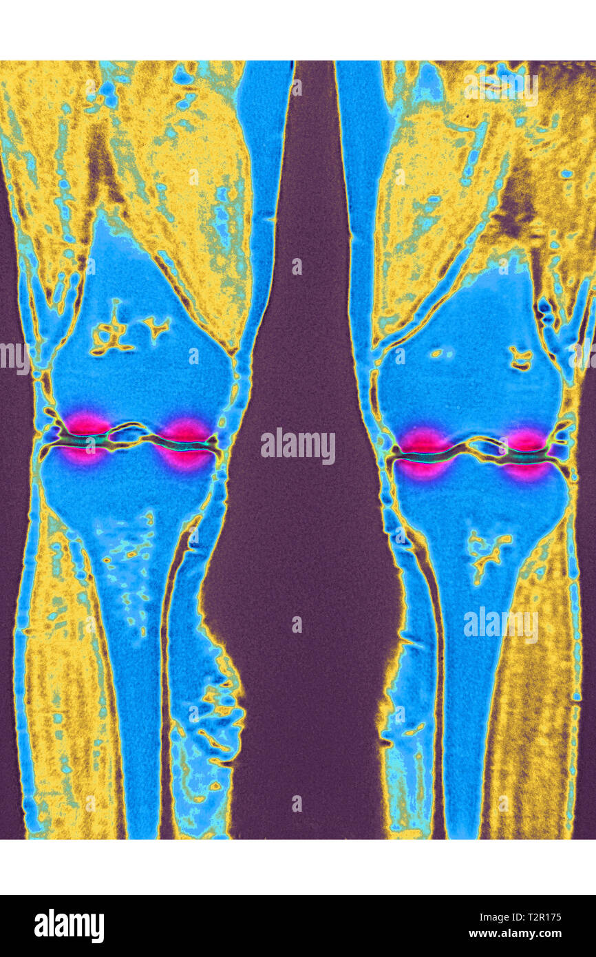 Lower limb mri hi-res stock photography and images - Alamy
