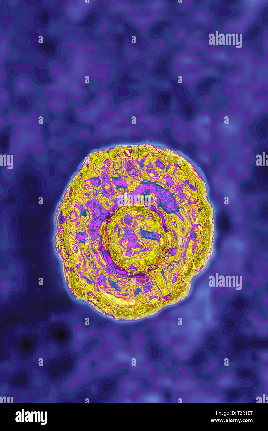 Hepacivirus hi-res stock photography and images - Alamy