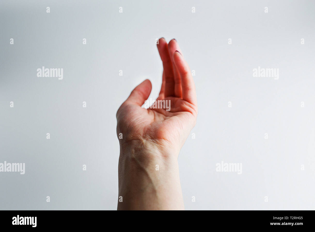Scars arm hi-res stock photography and images - Alamy