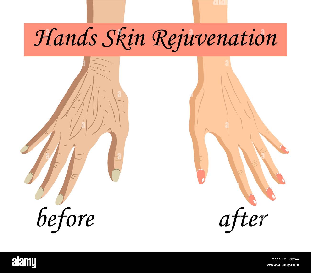 Hand skin rejuvenation, before after vector illustration isolated on ...