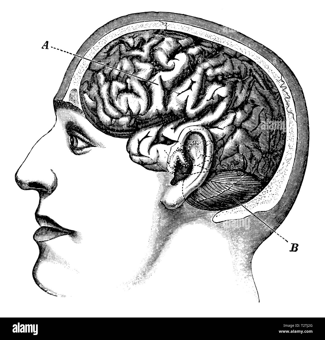 Großhirn Black and White Stock Photos & Images - Alamy