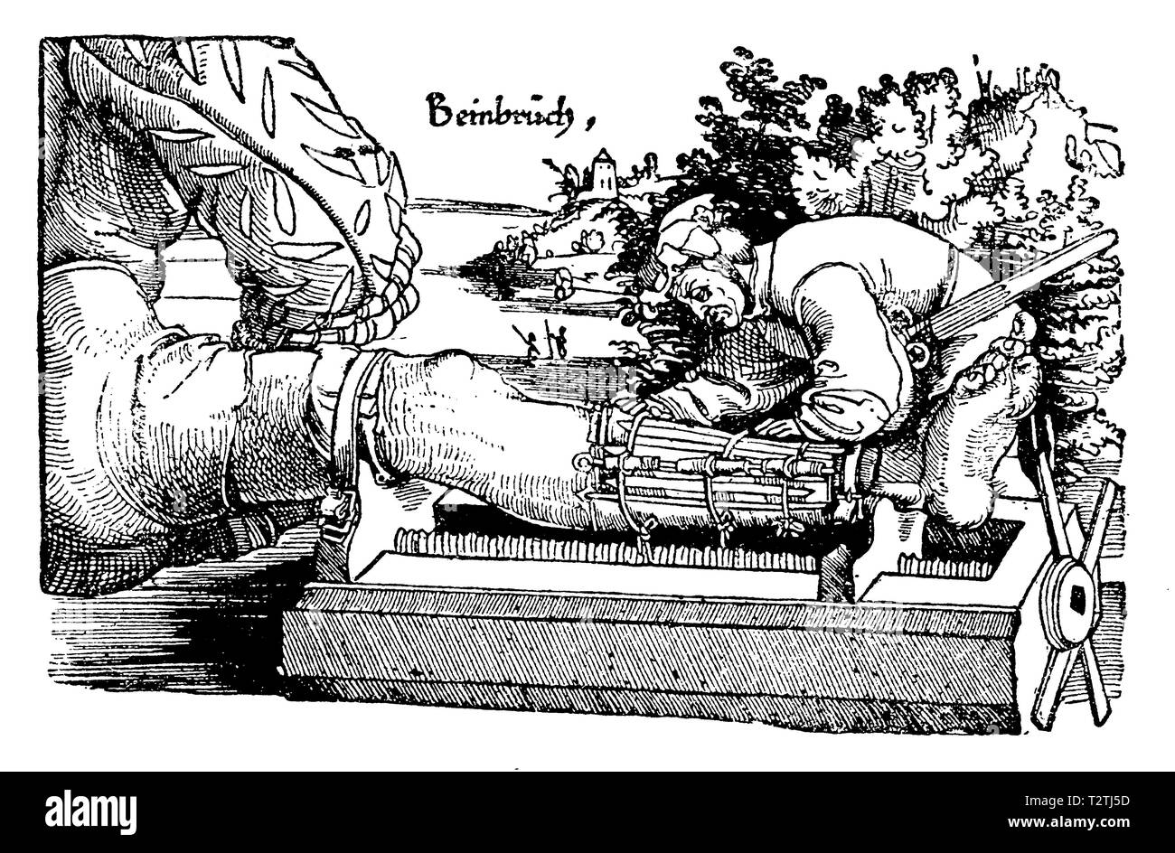 Wounded leg Black and White Stock Photos & Images - Alamy