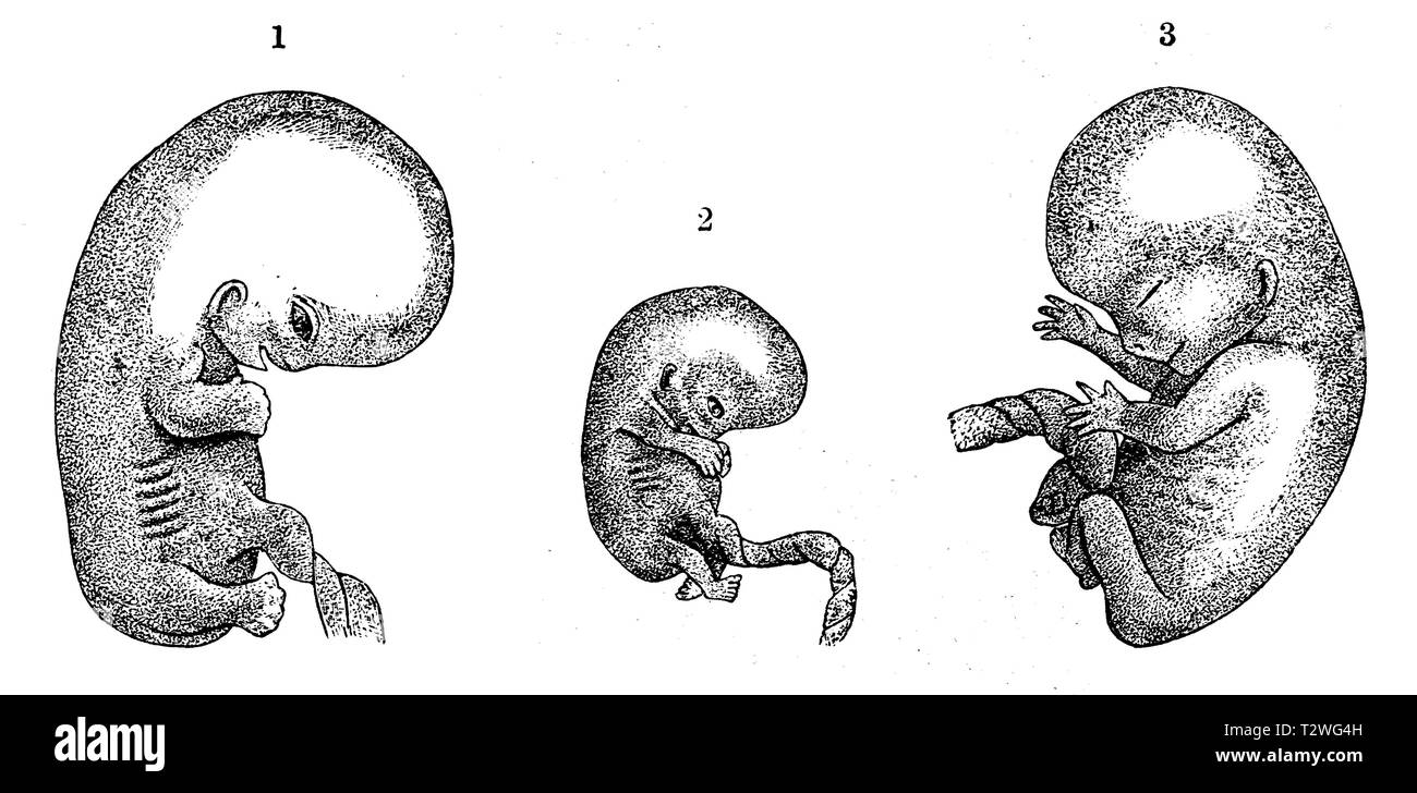 3 1 2 week human embryo hi-res stock photography and images - Alamy