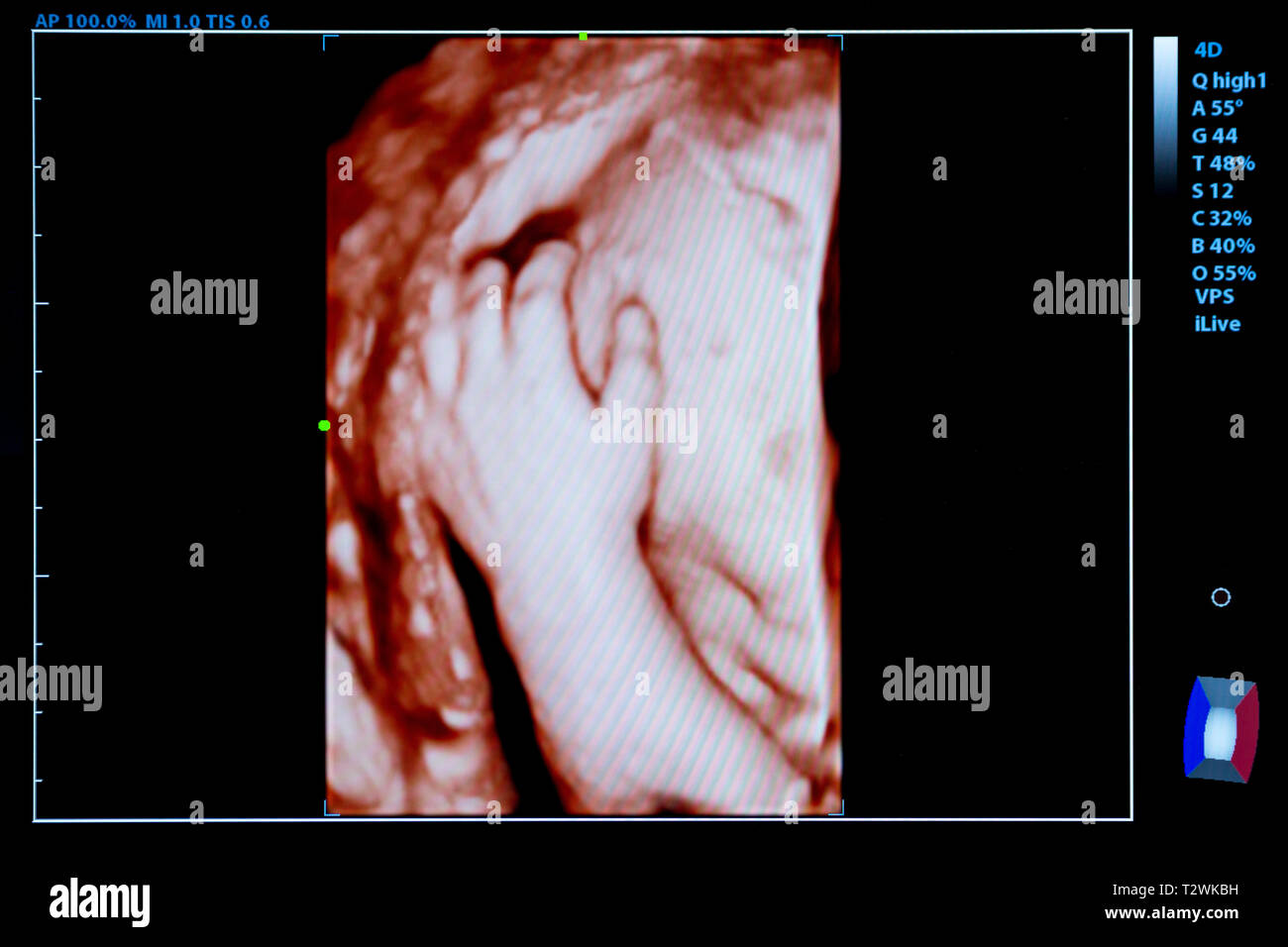 Colourful image of modern ultrasound monitor. Ultrasonography machine ...