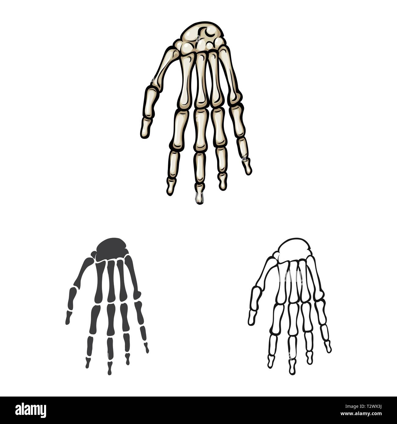 wrist,hand,calcium,structure,arm,carpus,health,xray,finger,injury ...