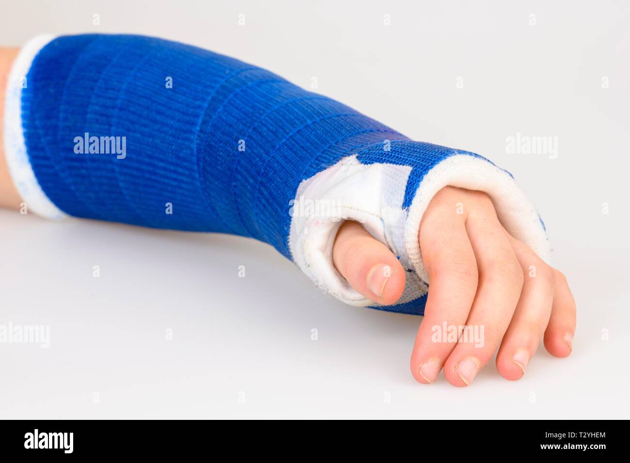 Wrist plaster hi-res stock photography and images - Alamy