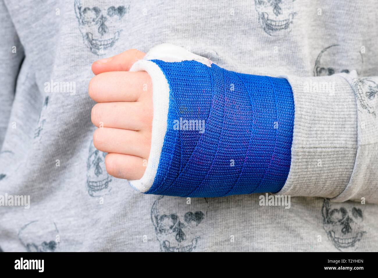 Wrist plaster hi-res stock photography and images - Alamy